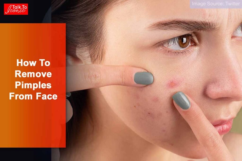 How To Remove Pimples From Face: Get Rid of Pimples Fast - Talk To Iconic